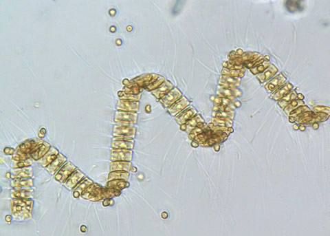 Centric Diatom, Chaetoceros sp.